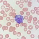 Promyelocytes: Identification & Differentiation