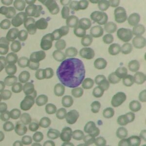 Promyelocytes: Identification & Differentiation
