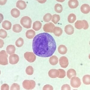 Promyelocytes: Identification & Differentiation