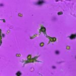 Ammonium Biurate Crystal Identification