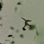 Ammonium Biurate Crystal Identification
