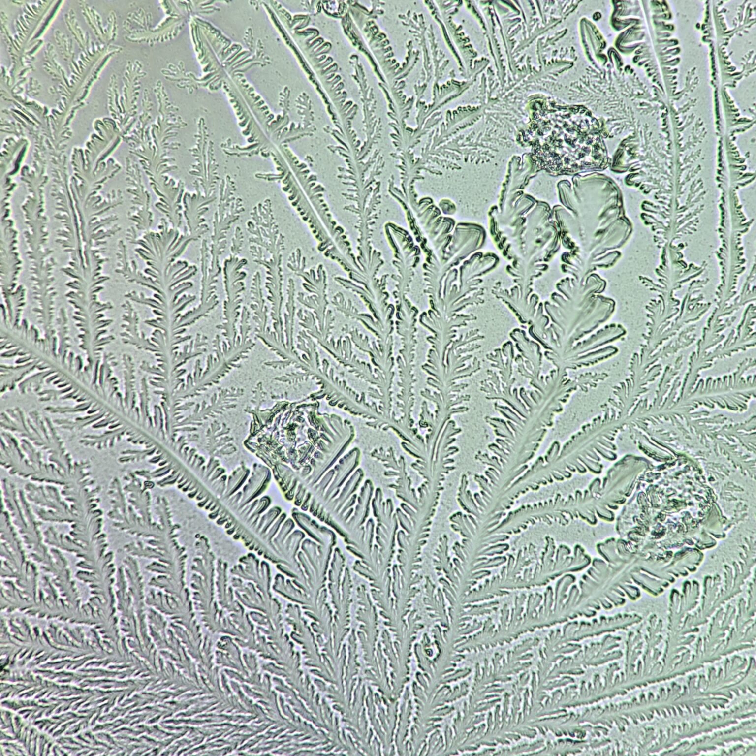 Fern Test Overview: Appearance and Clinical Significance
