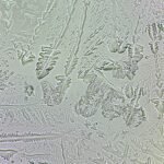 Fern Test Overview: Appearance and Clinical Significance