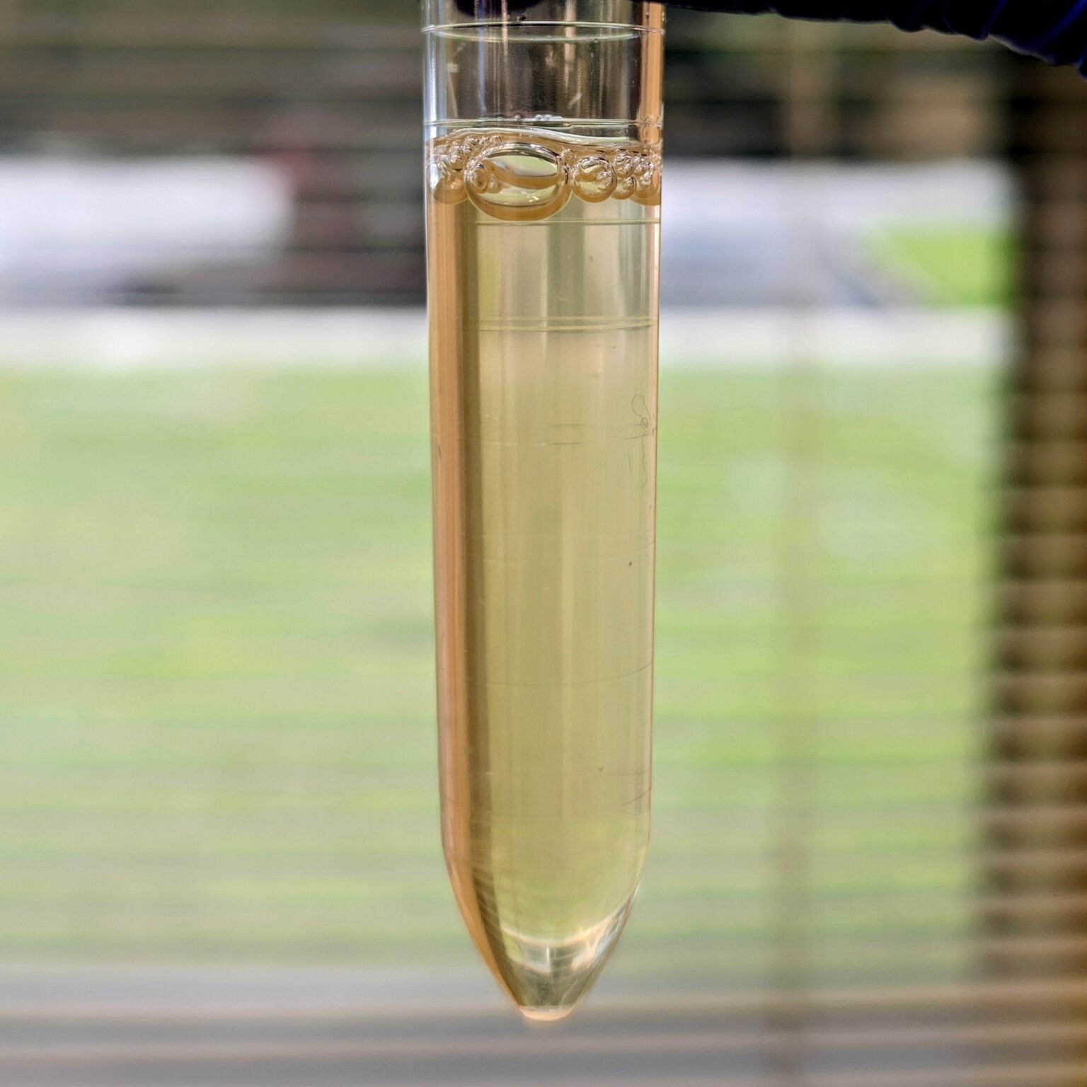 Amorphous Phosphates in Urine & What to Do - MedLabBuddy