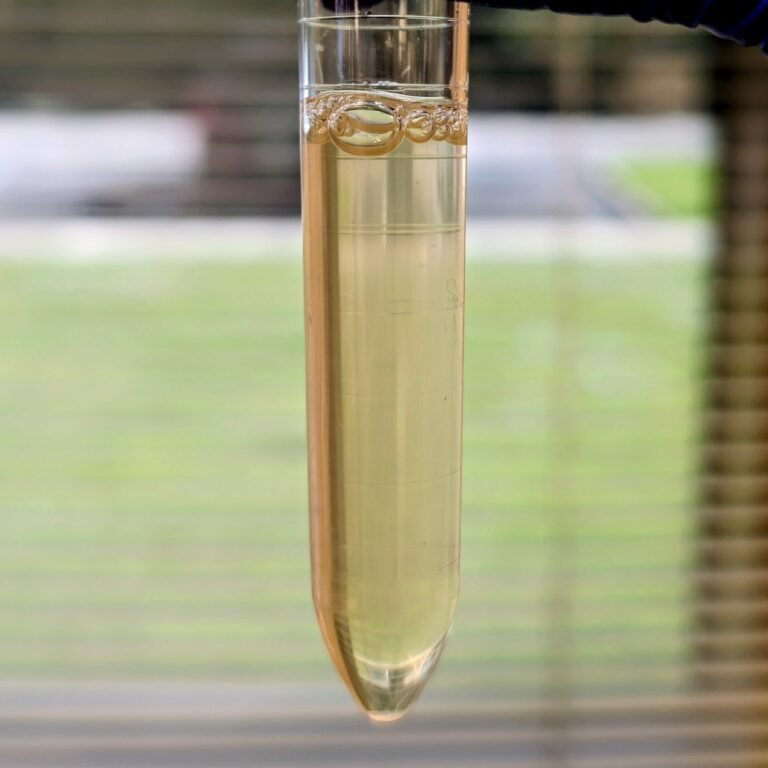 Amorphous Phosphates in Urine & What to Do - MedLabBuddy