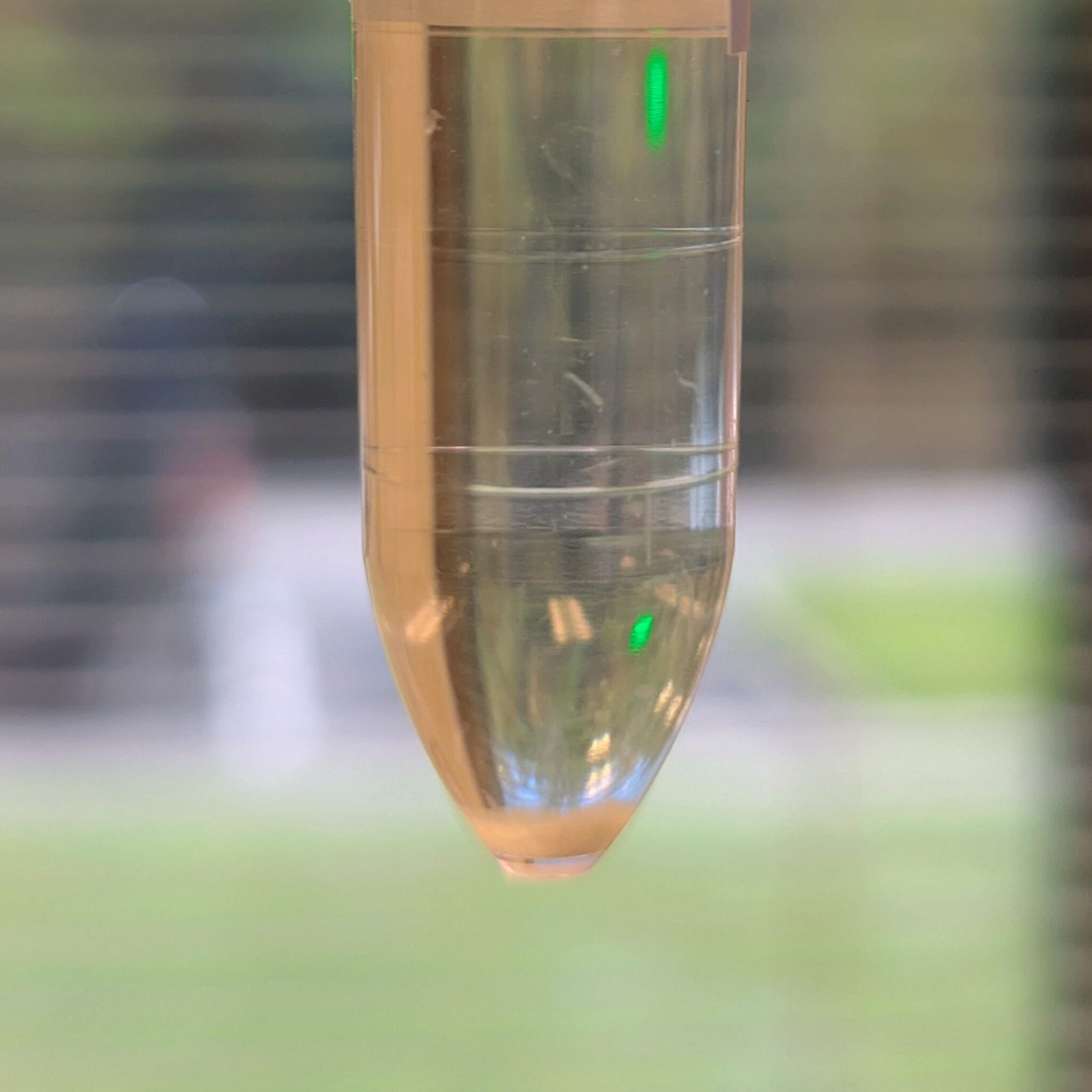 Amorphous Urates: Identification & Clinical Significance