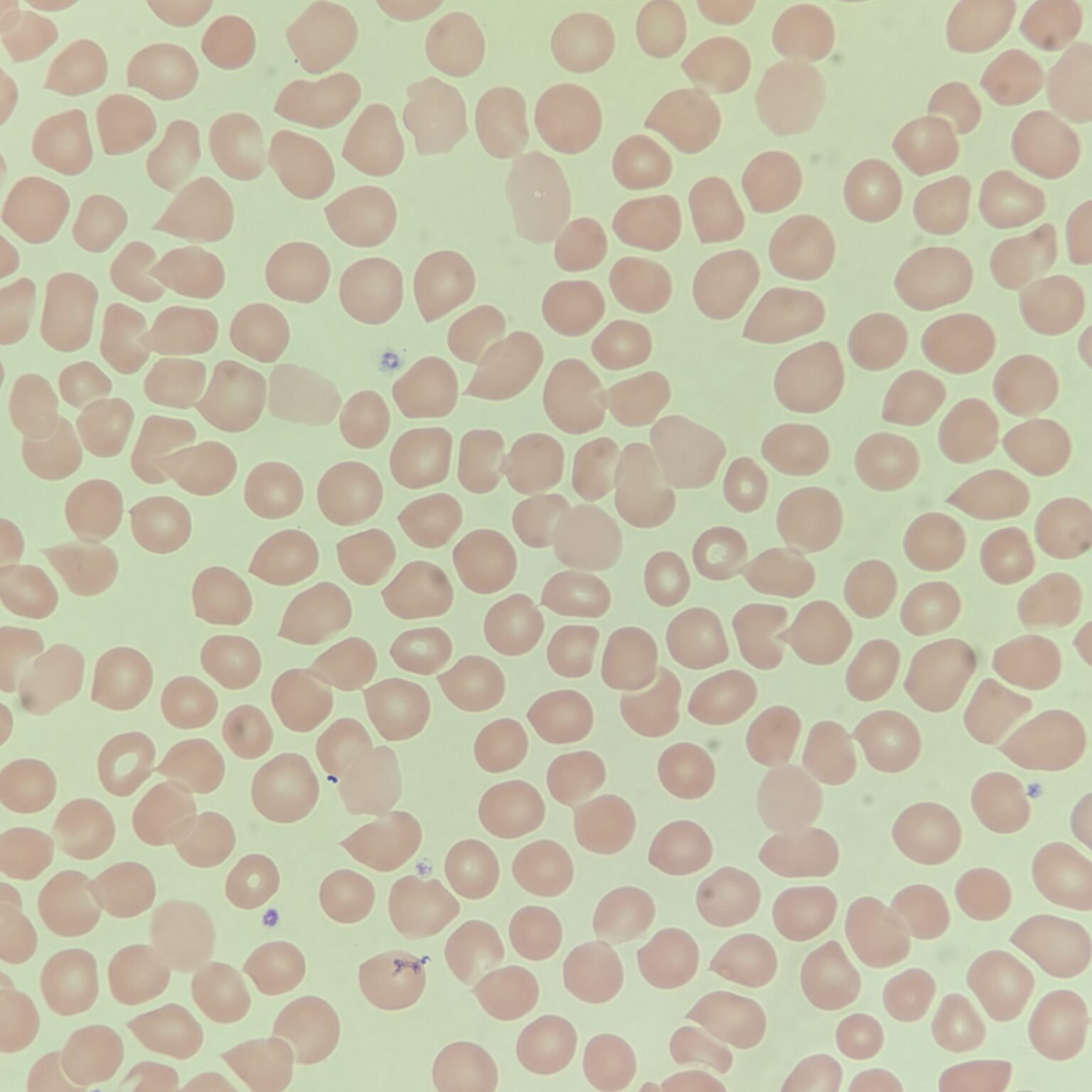 RBC Artifacts