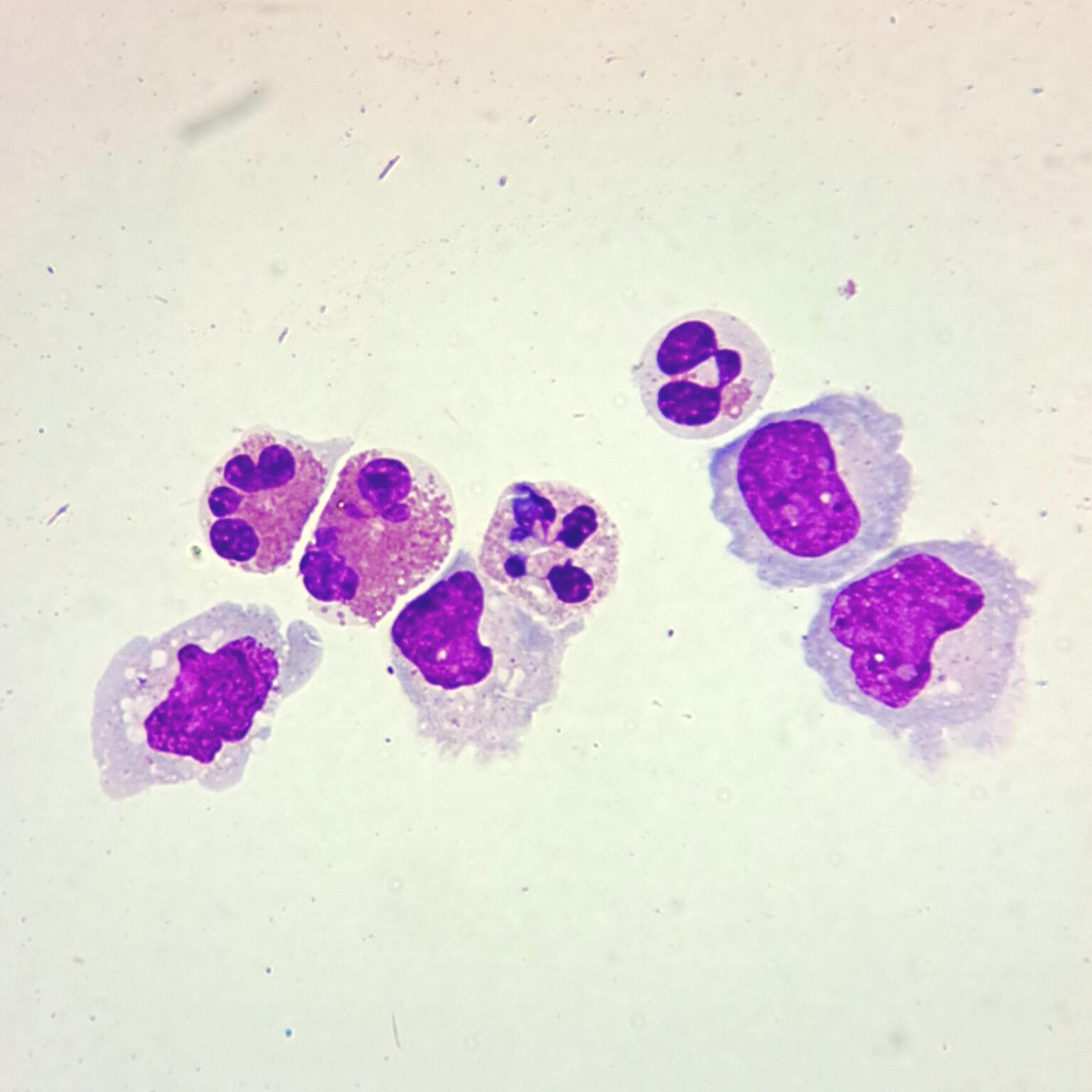 Body Fluid Eosinophils - MedLabBuddy