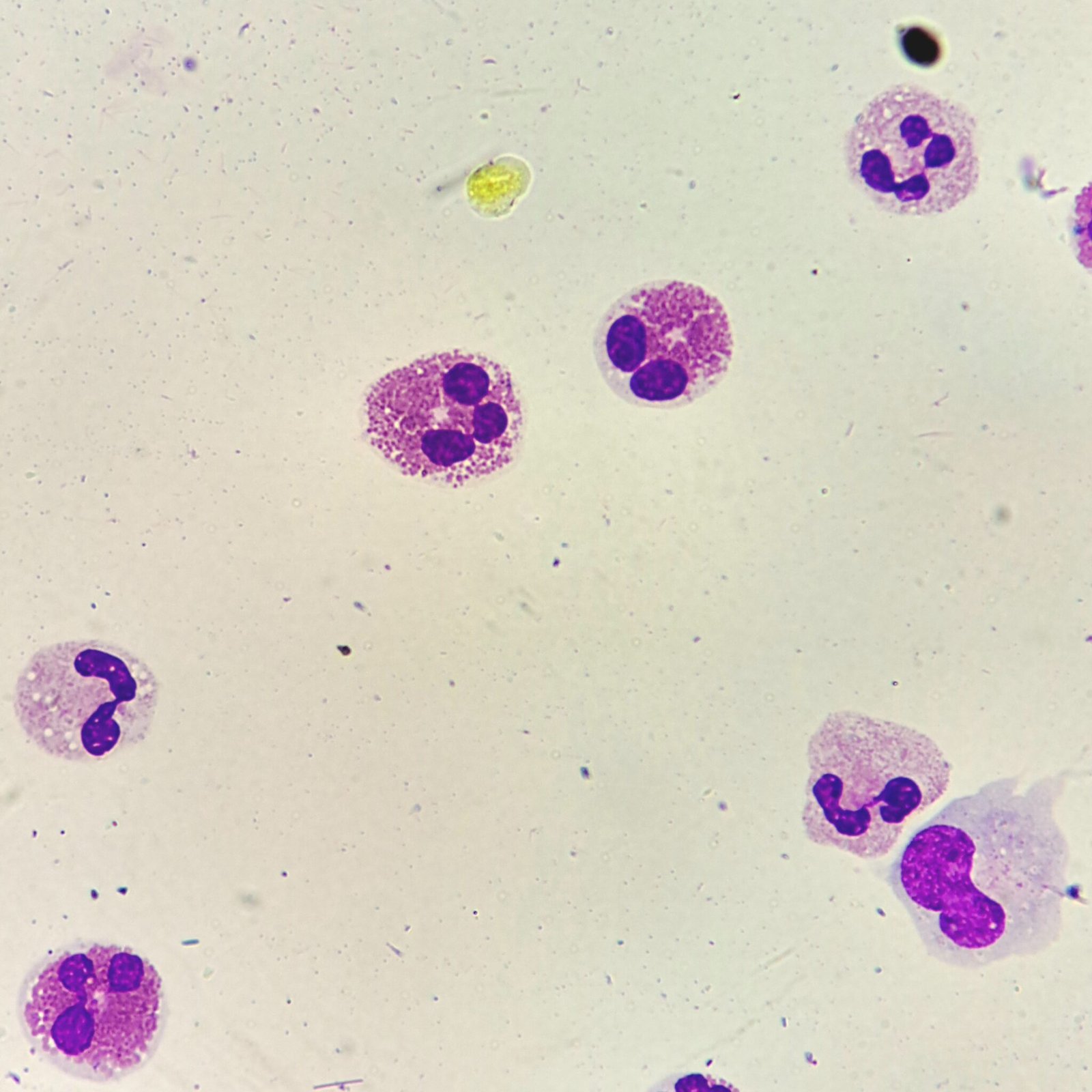 Body Fluid Monocytes / Macrophages - MedLabBuddy