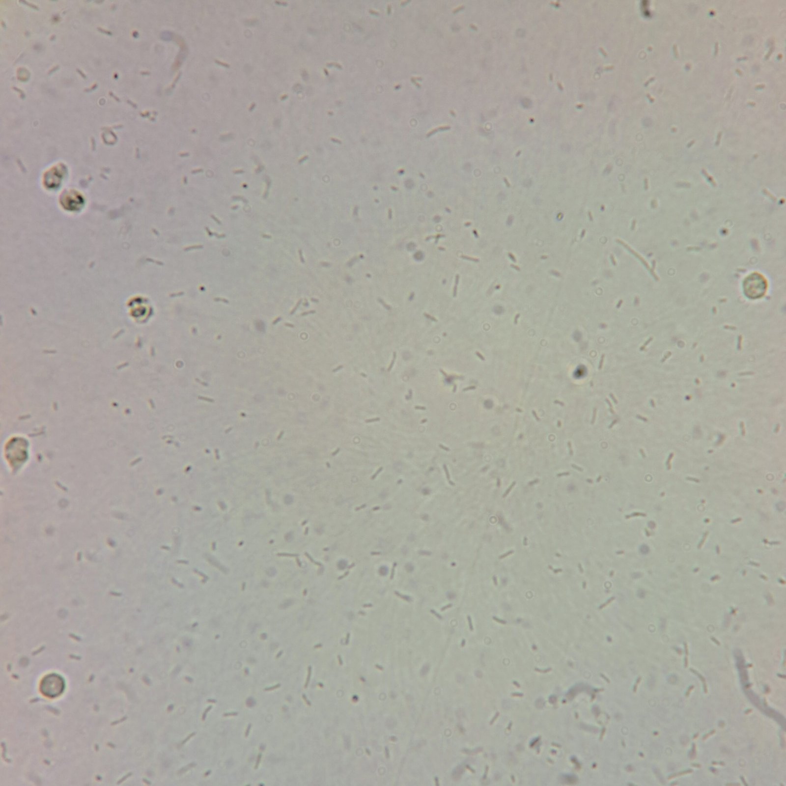 Bacteriuria: Bacteria in Urine - MedLabBuddy
