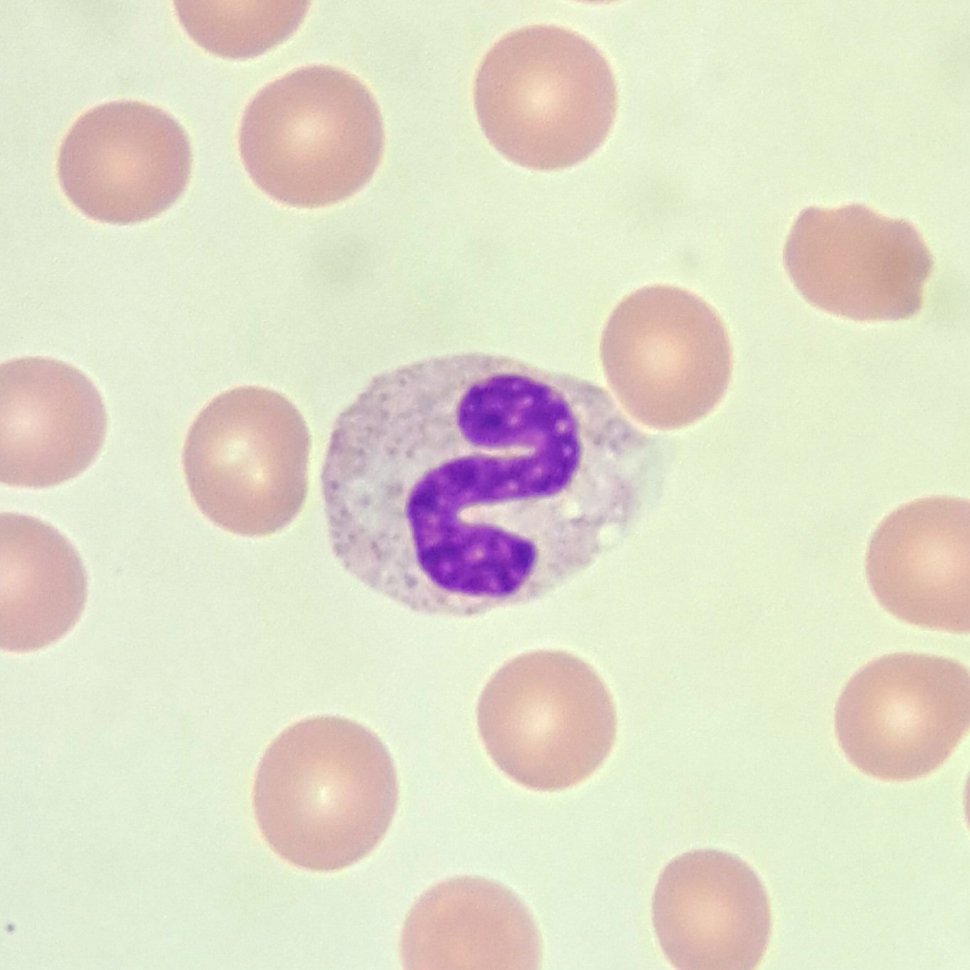 Band Neutrophils: Identification & Differentiation