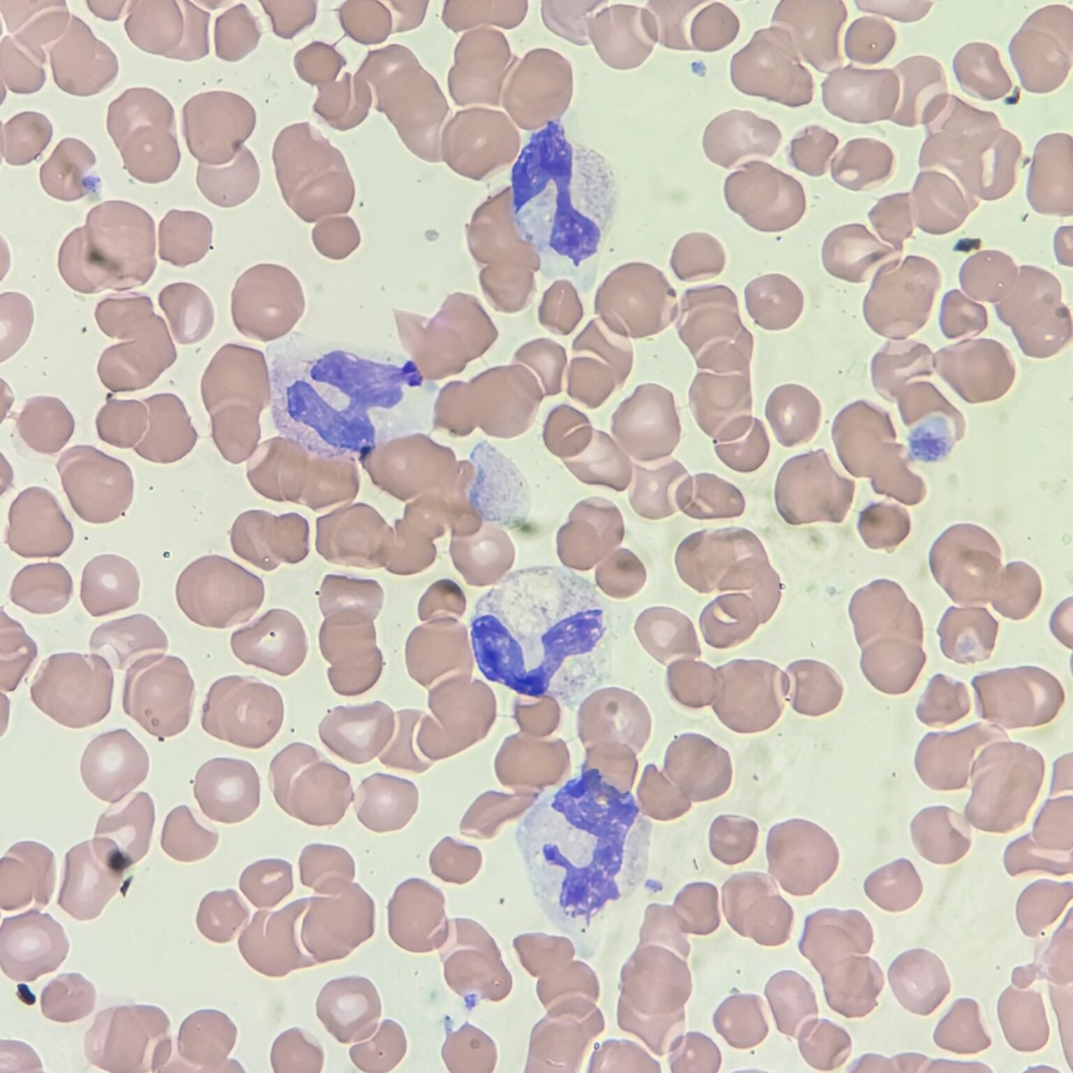 Band Neutrophils: Identification & Differentiation