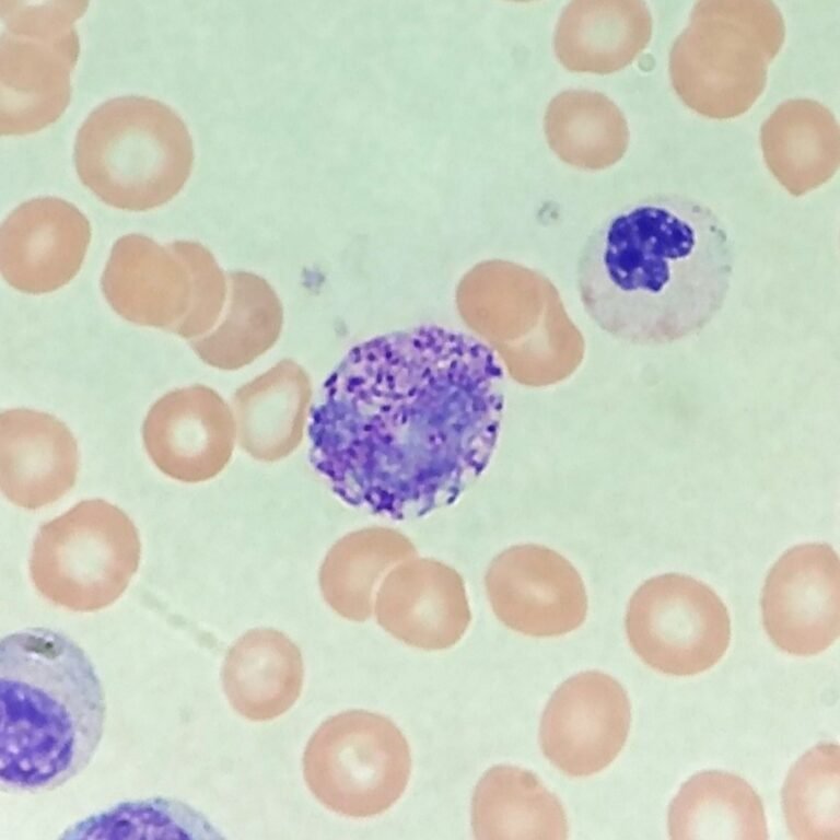 Basophils: Identification & Differentiation