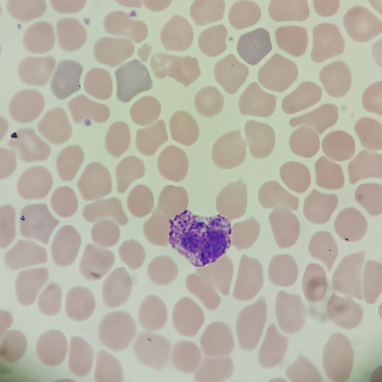 Basophils: Identification & Differentiation