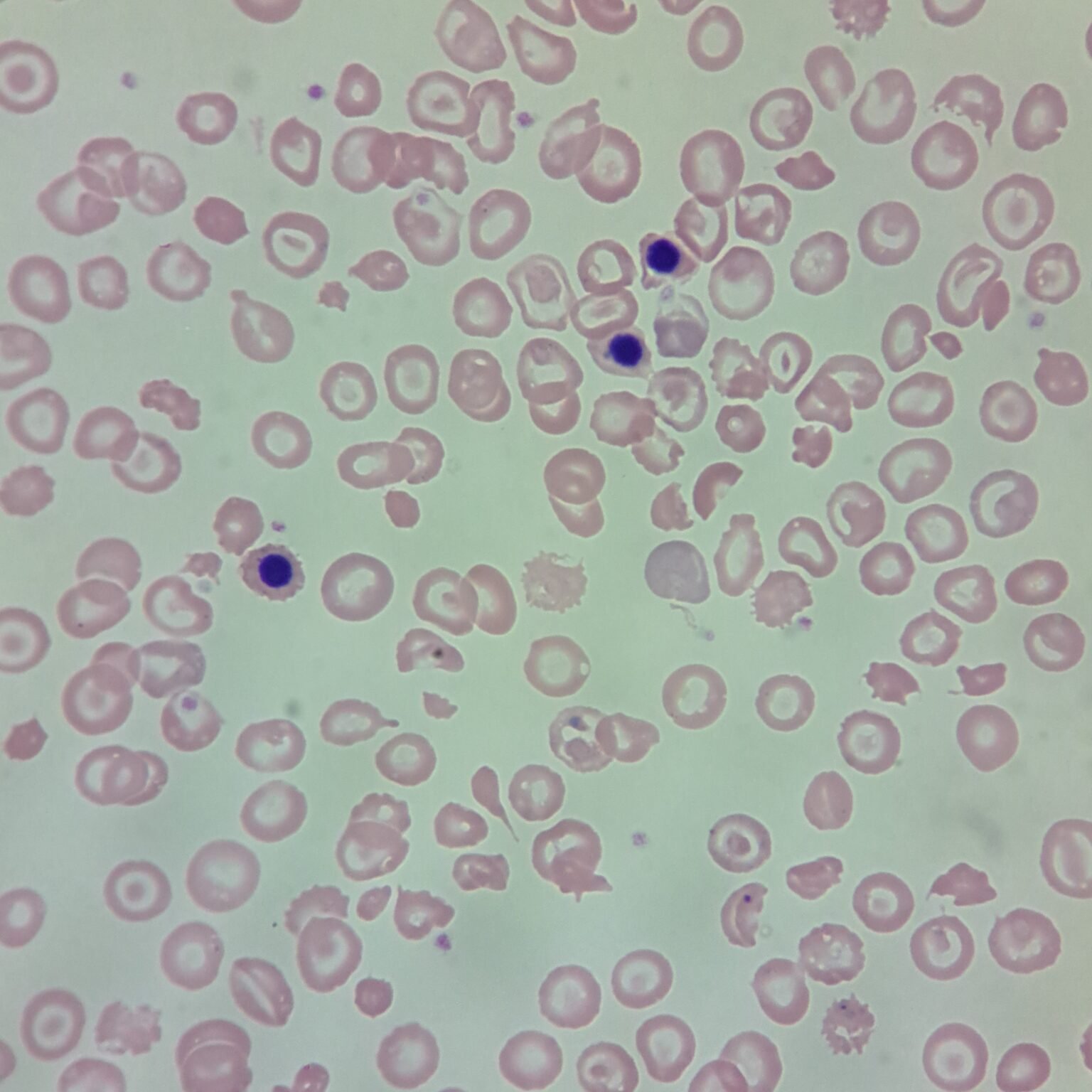 Red Blood Cell Lineage: Identification & Differentiation