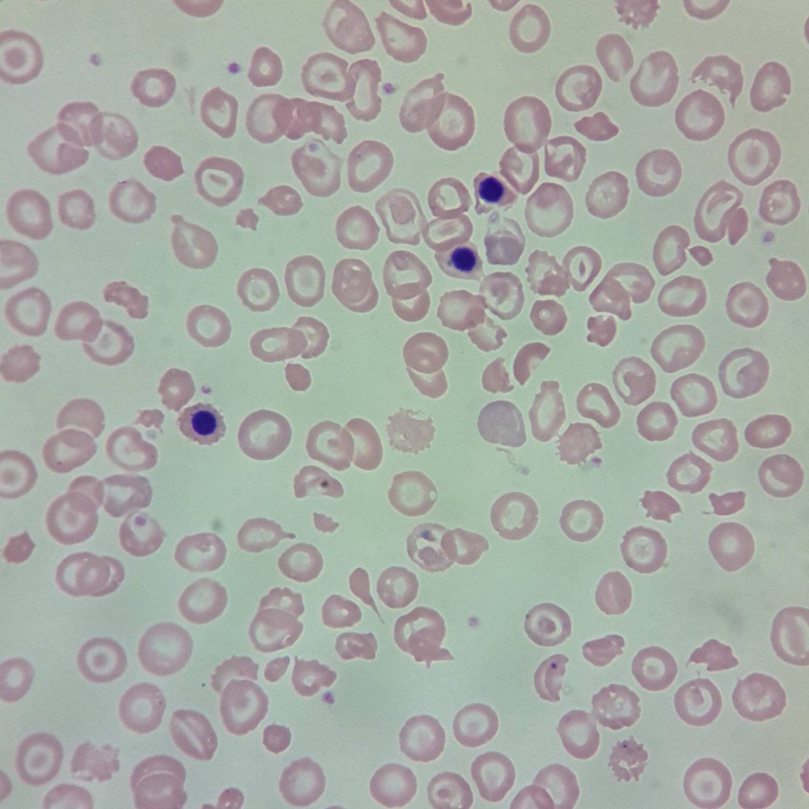 Red Blood Cell Lineage: Identification & Differentiation