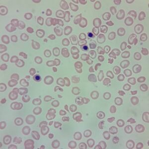 Red Blood Cell Lineage: Identification & Differentiation