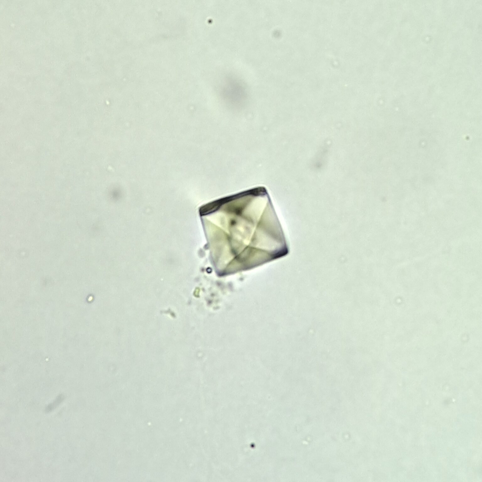 Calcium Oxalate Crystals: Identification & Clinical Significance