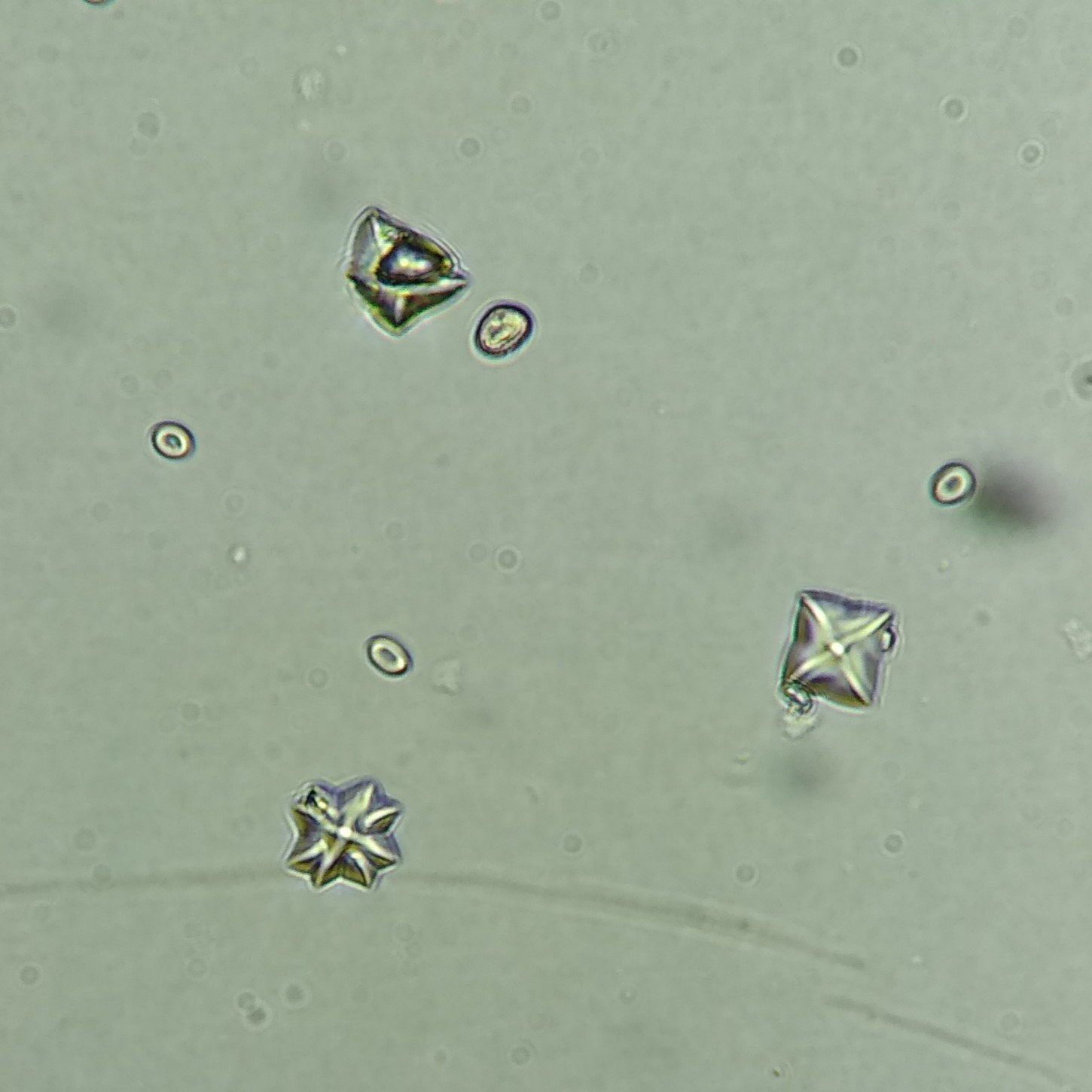 Calcium Oxalate Crystals: Identification & Clinical Significance
