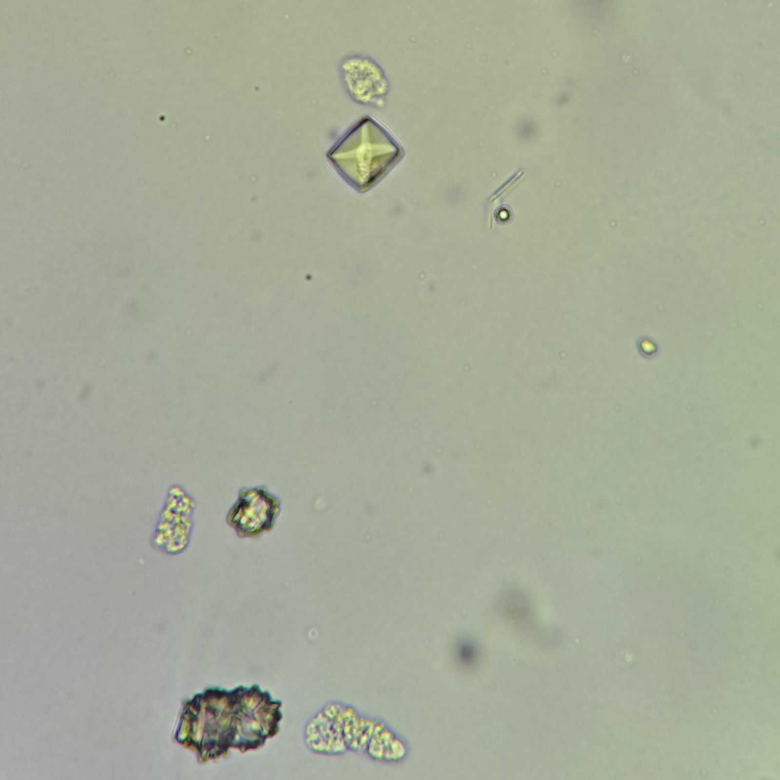 Calcium Oxalate Crystals: Identification & Clinical Significance