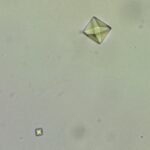 Calcium Oxalate Crystals: Identification & Clinical Significance
