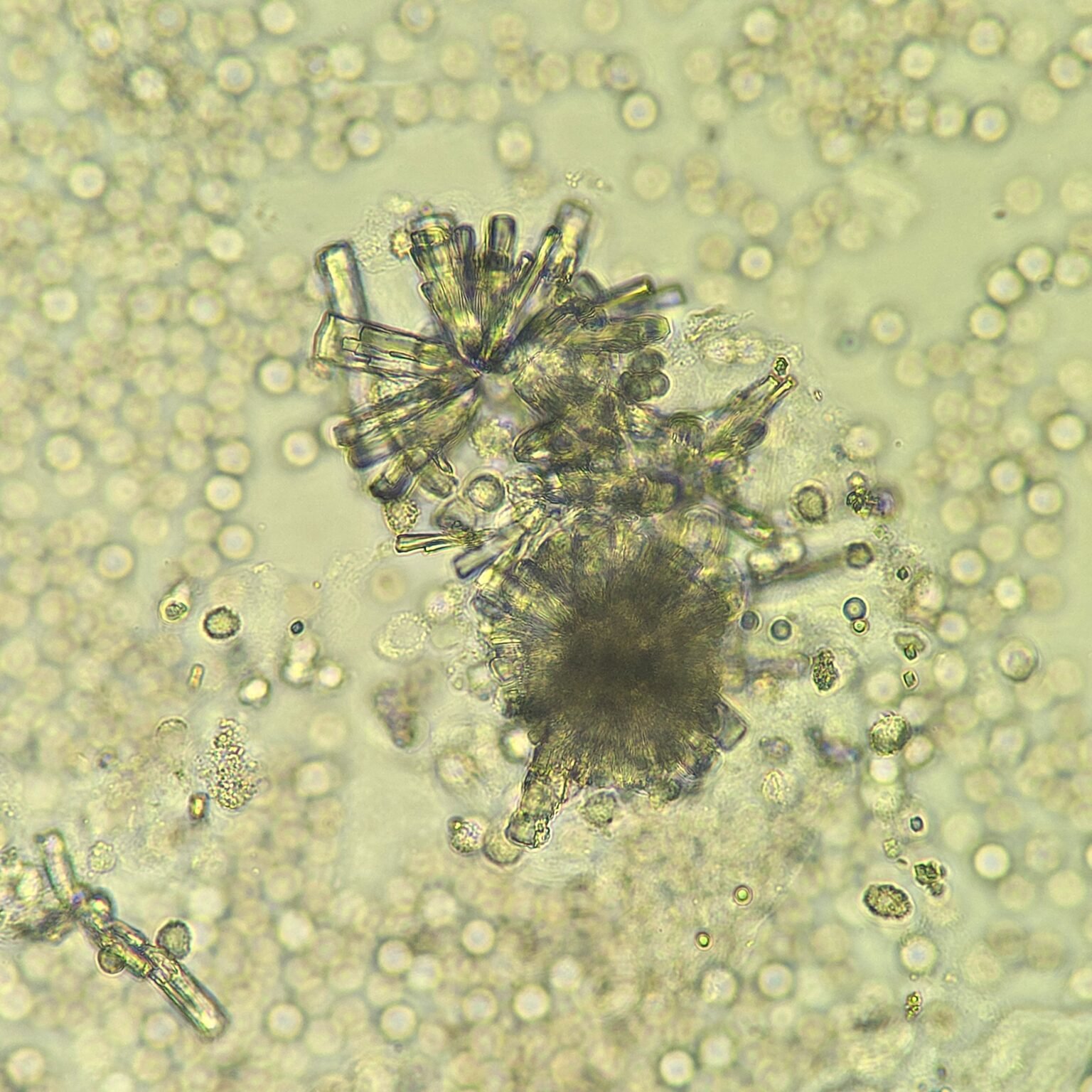 Calcium Phosphate Crystals: Identification & Clinical Significance