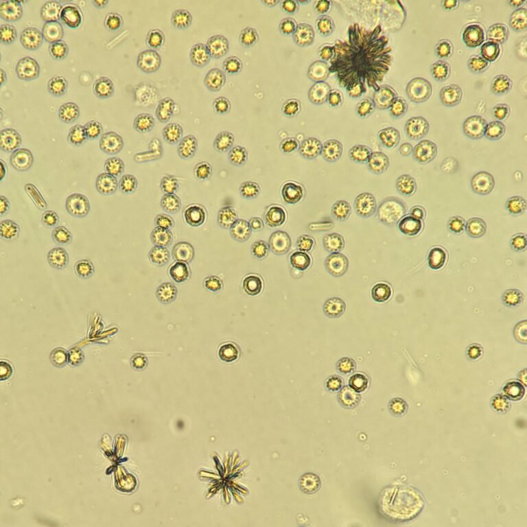 Calcium Phosphate Crystals: Identification & Clinical Significance