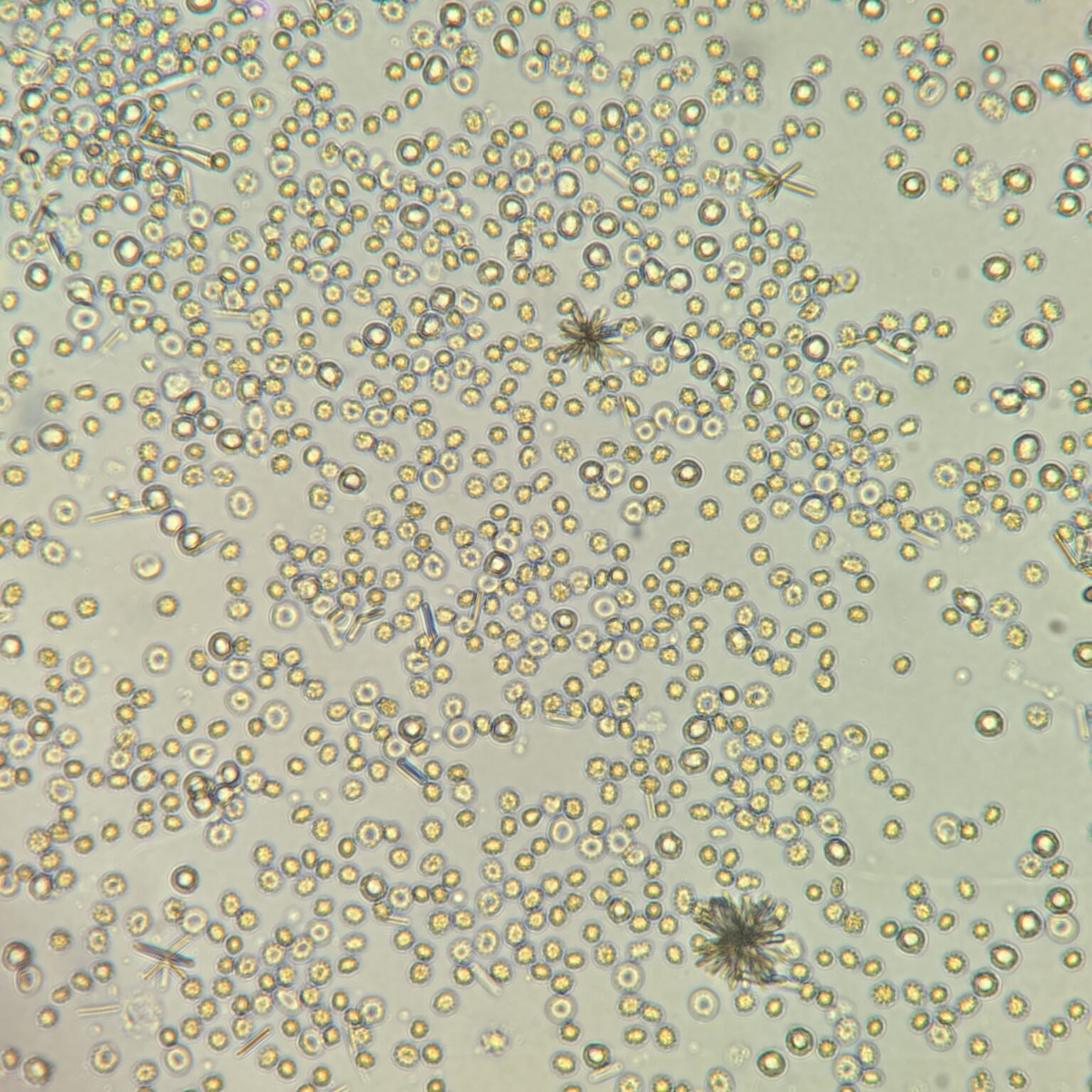 Calcium Phosphate Crystals: Identification & Clinical Significance
