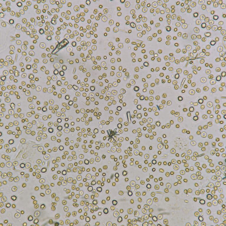 Calcium Phosphate Crystals: Identification & Clinical Significance