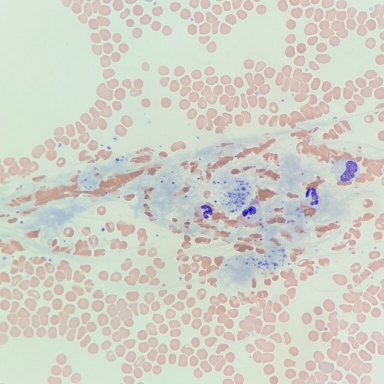 Platelets: Giant & Large, Clots & Clumps