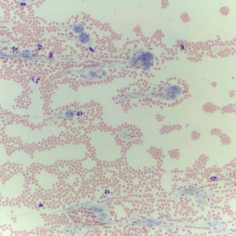 Platelets: Giant & Large, Clots & Clumps