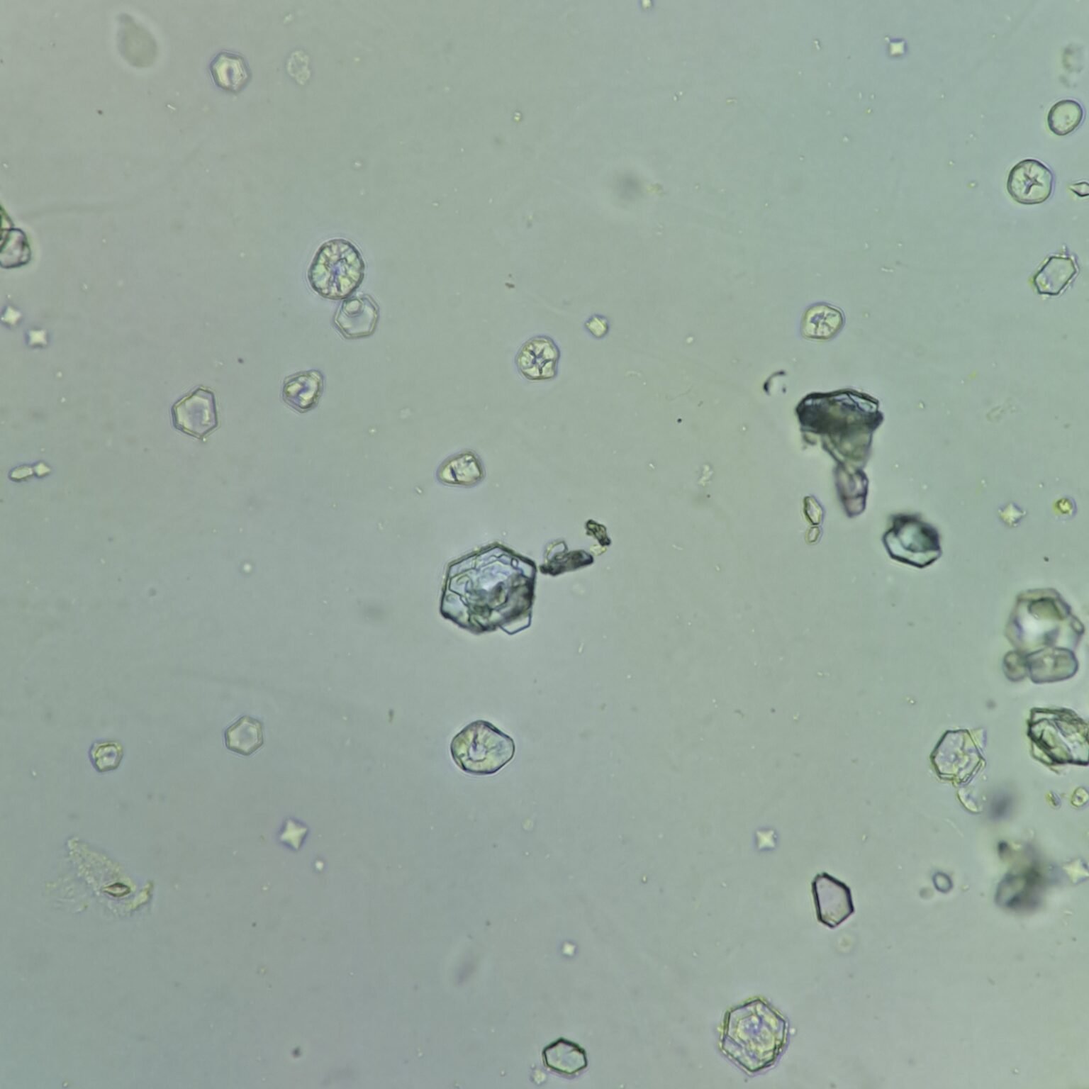 Cystine Crystals: Identification & Clinical Significance