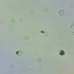 Cystine Crystals: Identification & Clinical Significance