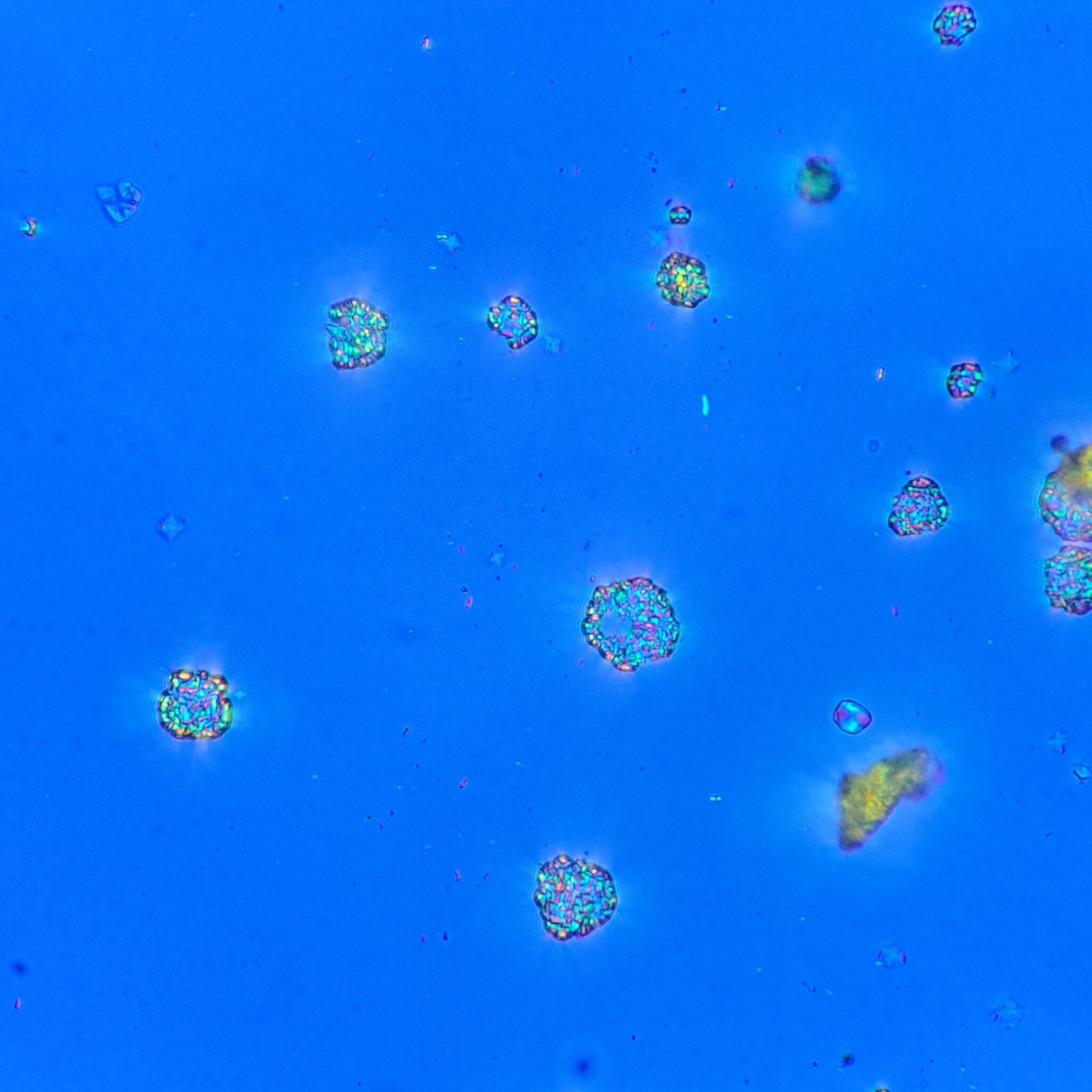 Cystine Crystals: Identification & Clinical Significance
