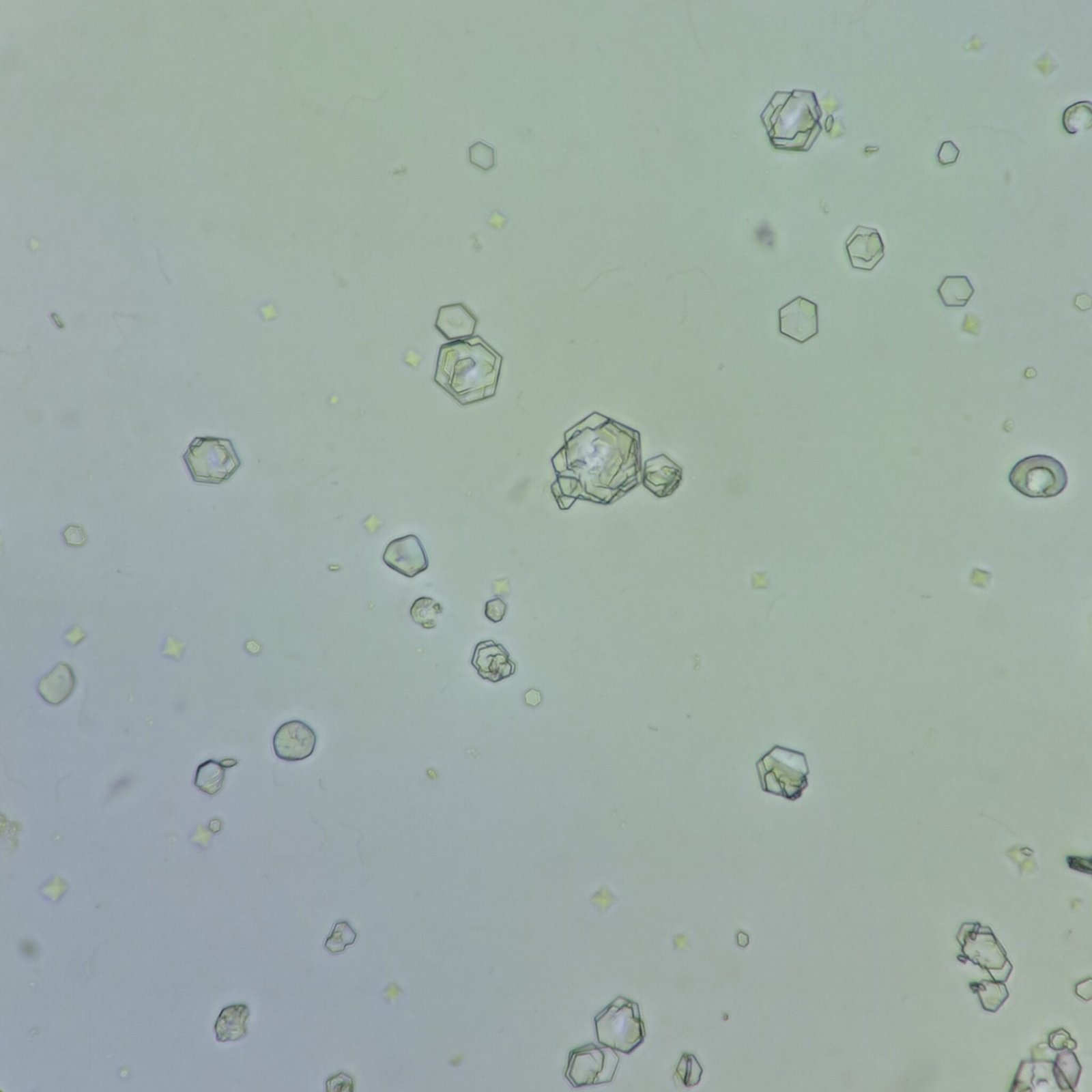 Cystine Crystals: Identification & Clinical Significance