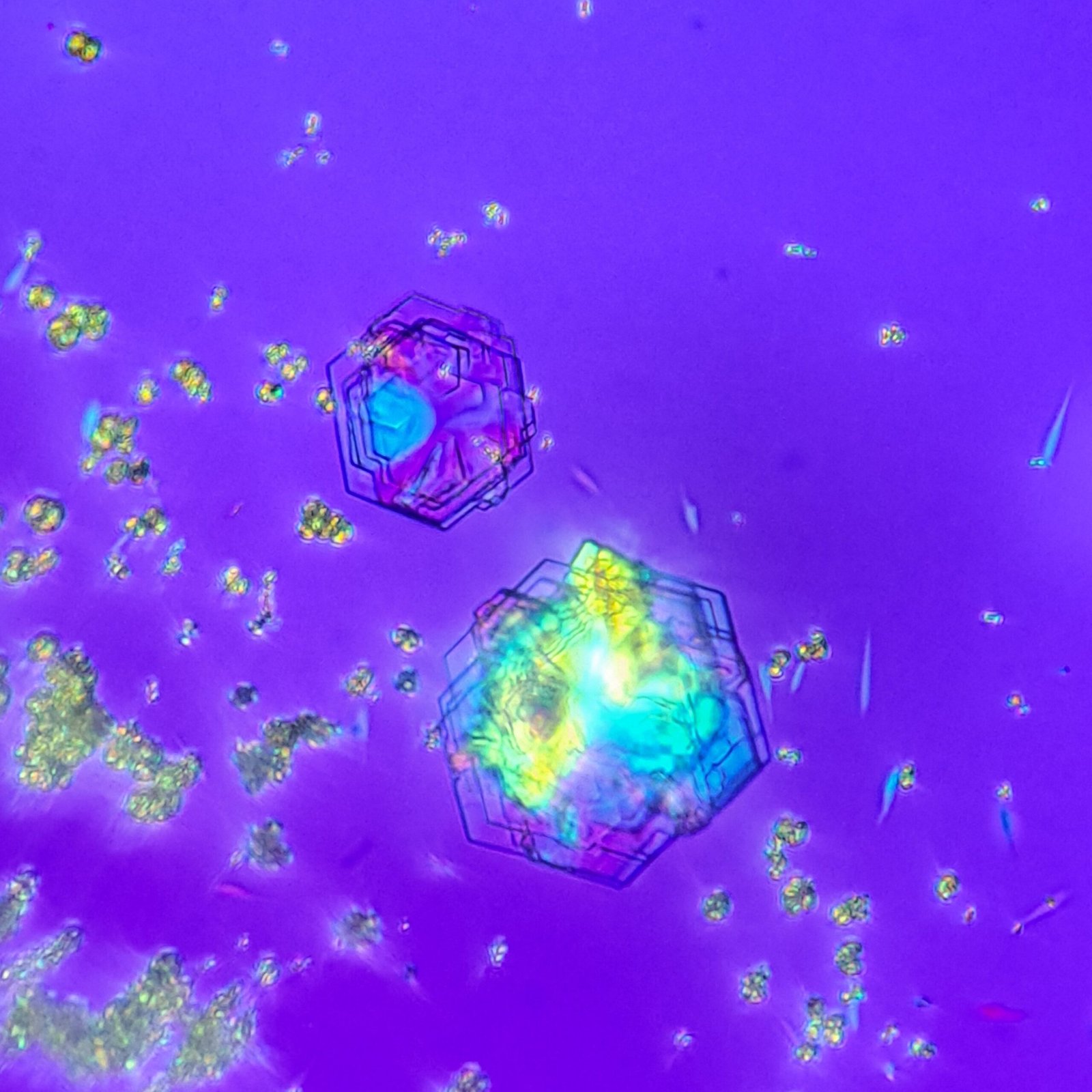 Cystine Crystals: Identification & Clinical Significance