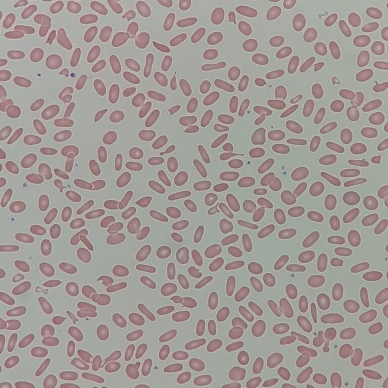 Elliptocytes / Ovalocytes: Appearance & Clinical Significance - MedLabBuddy