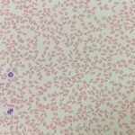 Elliptocytes / Ovalocytes: Appearance & Clinical Significance - MedLabBuddy