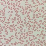Elliptocytes / Ovalocytes on Blood Smear: Morphology & Causes