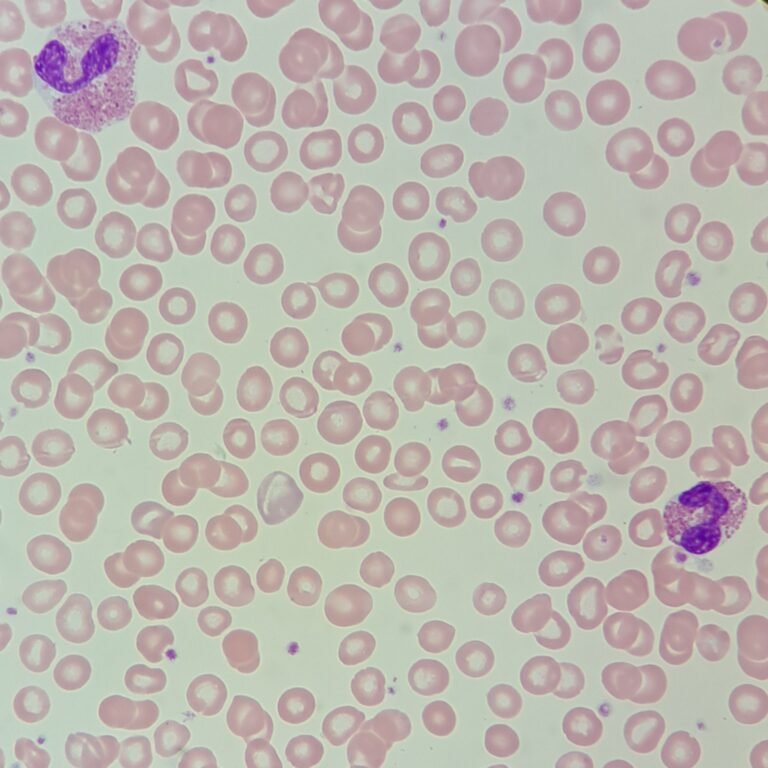 Eosinophils: Identification & Differentiation