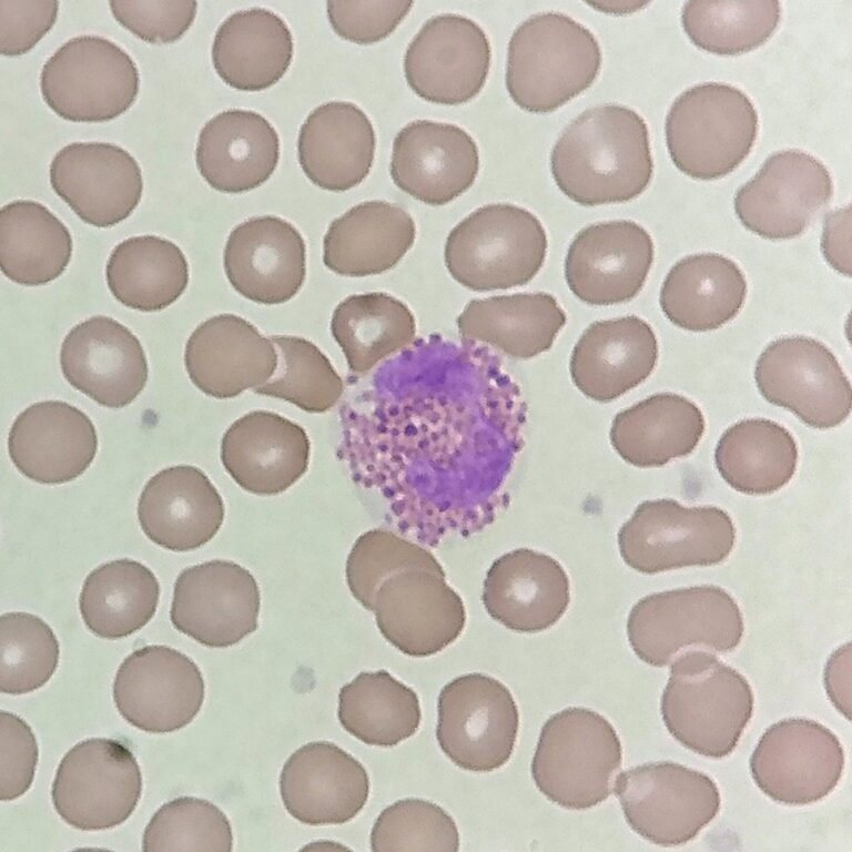 Eosinophils: Identification & Differentiation