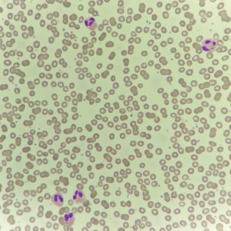 Eosinophils: Identification & Differentiation
