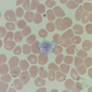 Platelets: Giant & Large, Clots & Clumps