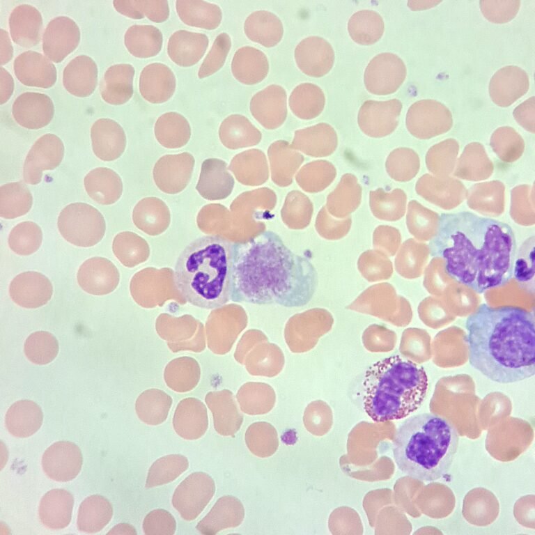 Platelets: Giant & Large, Clots & Clumps