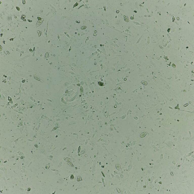 Hyaline Casts: Identification & Clinical Significance - MedLabBuddy