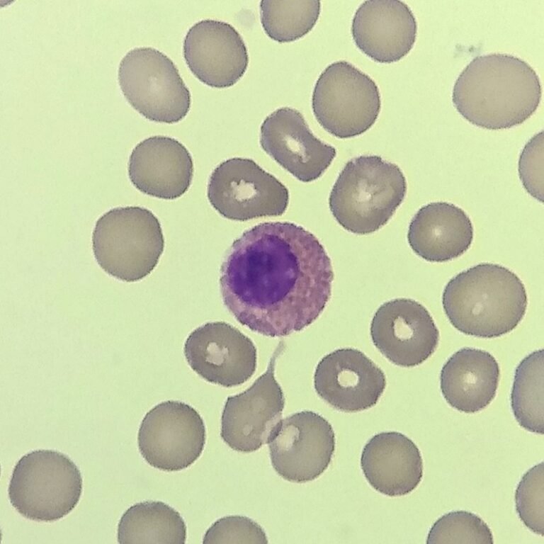 Eosinophils: Identification & Differentiation