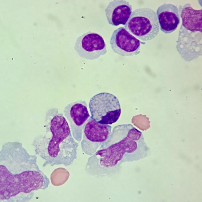 Mott Cells: Identification & Differentiation