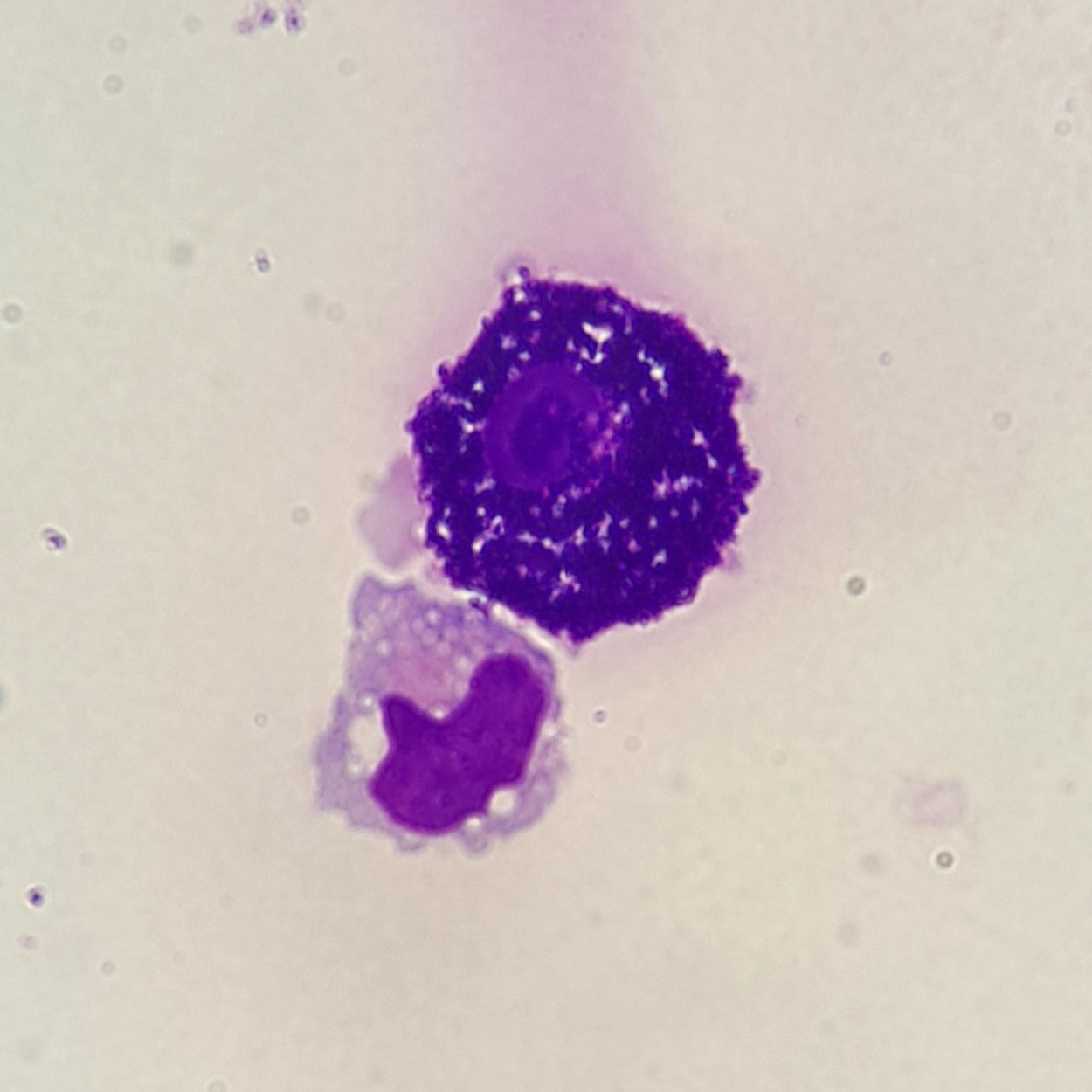 Mast Cells - MedLabBuddy