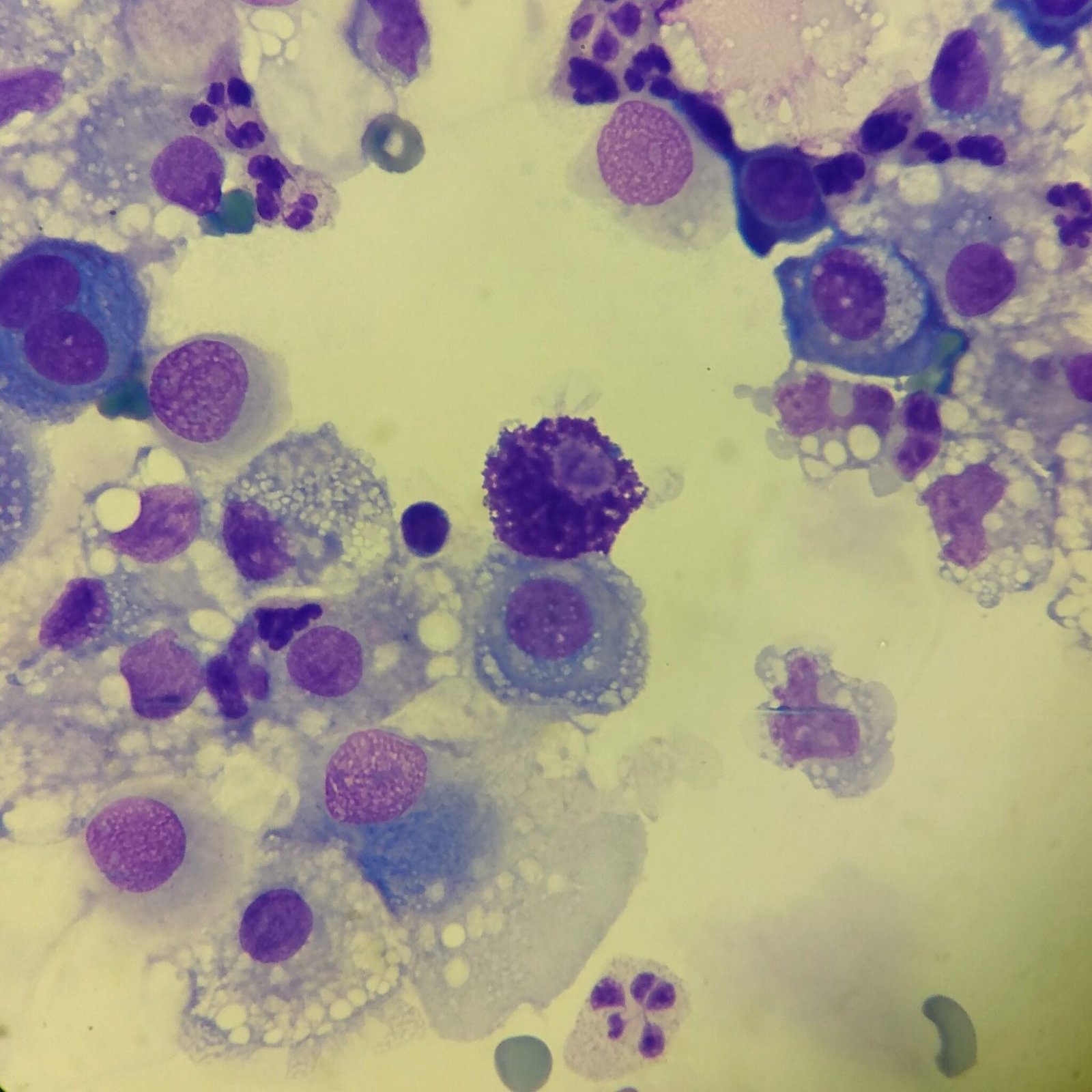 Mast Cells - MedLabBuddy
