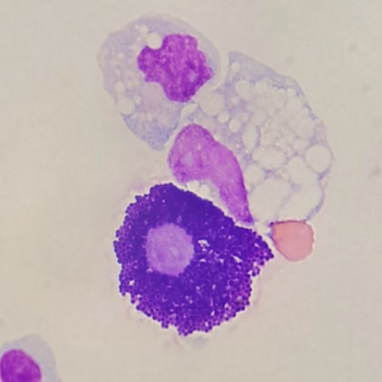 Mast Cells - MedLabBuddy